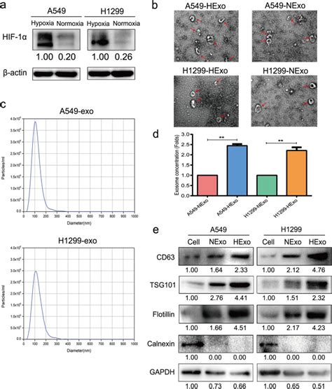 hypoxic tumor derived exosomal mir 31 5p promotes lung adenocarcinoma