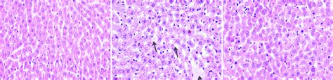 Liver Histological Analysis Stained With Hematoxylin And Eosin A