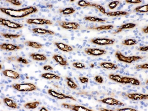Anti Slc12a1 Nkcc2 Antibody Rabbit Anti Human Polyclonal Ihcwb Lsbio