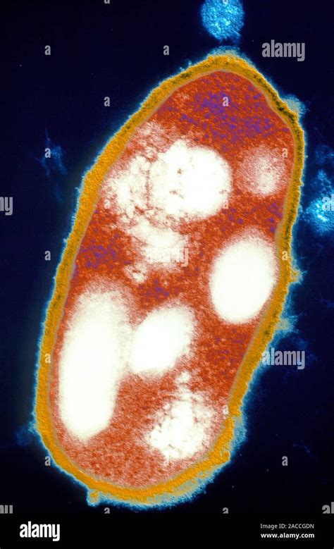 Haloferax Mediteranei Archaeon Coloured Transmission Electron Micrograph Tem Of A Section