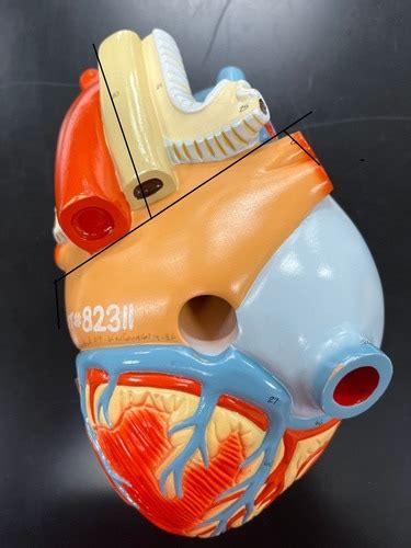 Cardiovascular System Lymphatic Lab Exam Flashcards Quizlet