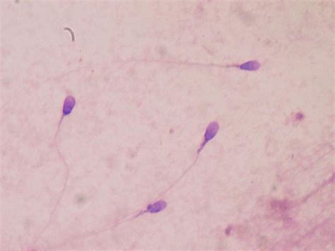 Freezing Testicle Tissue In Mice Brings Fertility Hope To Cancer