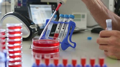 Central Biohub Gmbh On Linkedin Explore Hepatitis Samples Online From