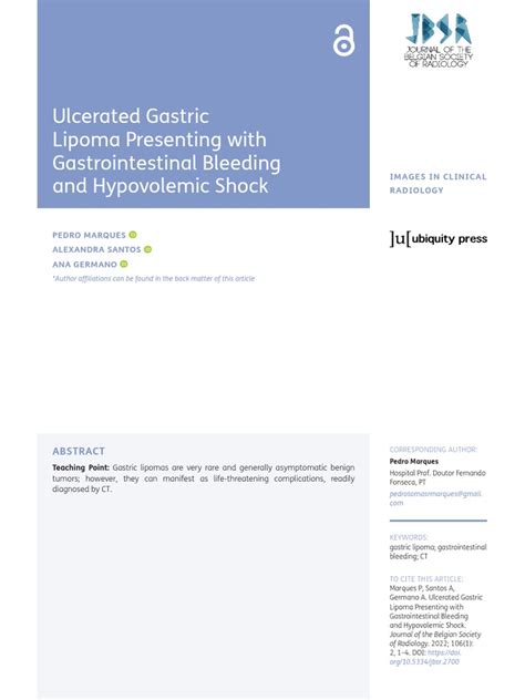 Ulcerated Gastric Lipoma Presenting With Gastrointestinal Bleeding And