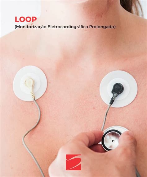 Loop Icor Instituto Do Coração De Santa Maria