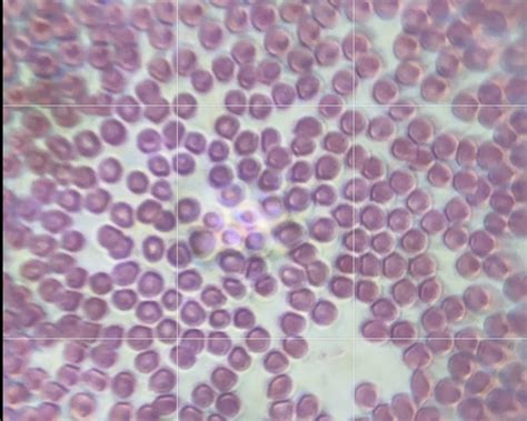 Adelle Yong Roboflow Universe