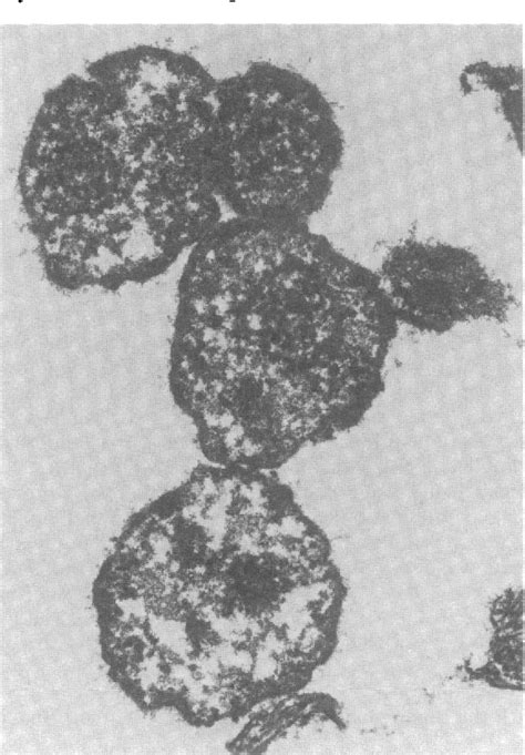 Figure 1 From Rapid Activation Of Protein Kinase C In Isolated Rat