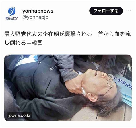 紅白歌合戦、視聴率が過去ワースト 第1部で初の30％割れ 第2部31 9％で過去最低より2 4ポイント減 ガールズちゃんねる