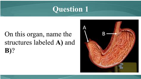 1 Diagram Quizlet