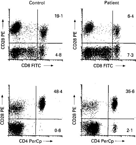 Expression Of Cd28 On Peripheral Blood T Lymphocyte Subsets Peripheral