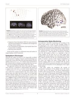 Braincomputer Interface Bci Applications In Mapping Of Epileptic
