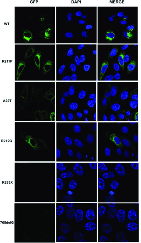 Subcellular Localization Of Wild Type And Mutant Il 12rβ1 Proteins