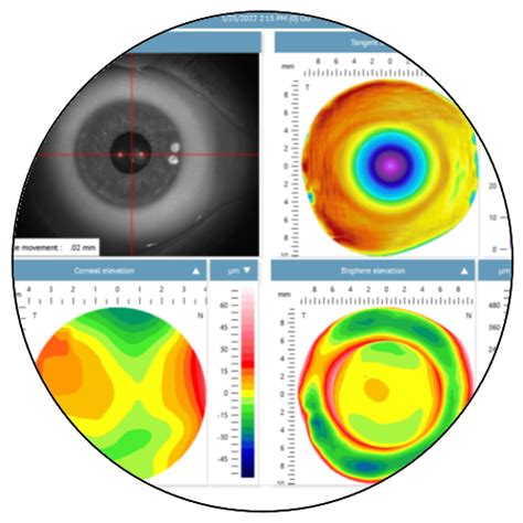 Contact Lens Institute Of Seattle