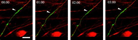 To Understand Cancer Dynamics Researchers Call The Cell Behavior Coiling