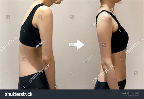771 골반 교정 이미지 스톡 사진 및 벡터 Shutterstock