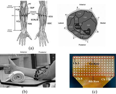 Surface Electromyography A Relationship Between Gesture And Forearm