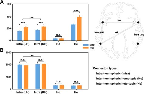主要抑郁症患者的功能和结构性半球脑网络的connectome分析。translational Psychiatry X Mol