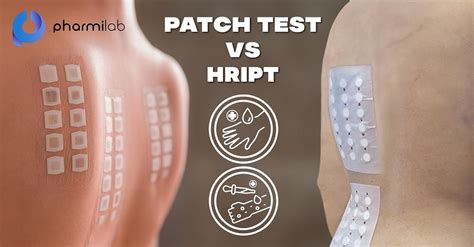 João Líbano Marques On Linkedin Hript Vs Patch Test What Are The Differences And Benefits