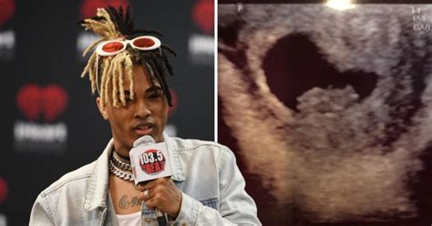 Xxxtentacions Mum Reveals Late Rappers Girlfriend Is Pregnant Metro