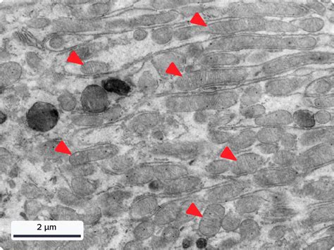 Assess Mitochondrial Morphotology Via Large Scale Fast Em Whitepaper