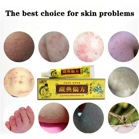 Buy 1pcs Natural Chinese Herbal Eczema Psoriasis Cream Dermatitis