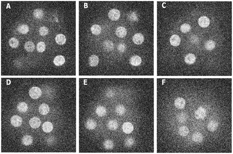 histogram equalized 2d sample images from our image dataset sample