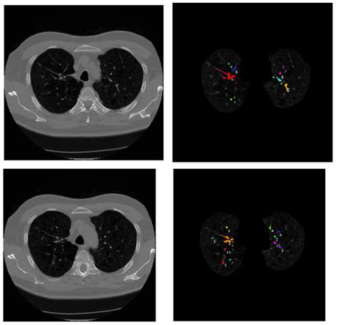 Deep Learning Based Feature Selection Algorithm For Small Targets Based On Mrmr