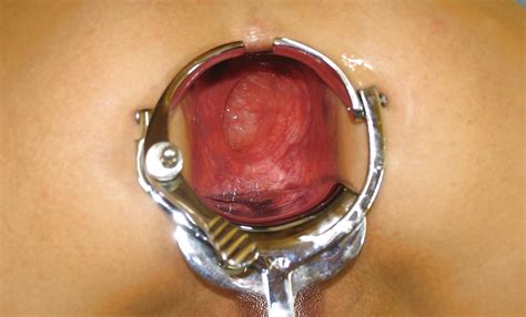 Pictures Of Incredible Anal Insertions By Mdf Porn Pictures Xxx