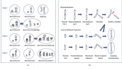 Translocation Down Syndrome Diagram