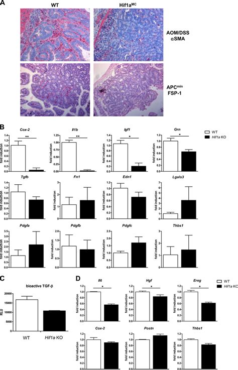 Hif1a In Myeloid Cells Is Essential For Activation And Pro Tumorigenic