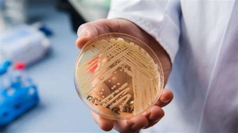 Washington State Sees Outbreak Of Deadly Candida Auris Infection Know