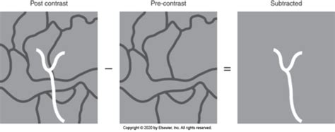 RADS Physics Module Flashcards Quizlet