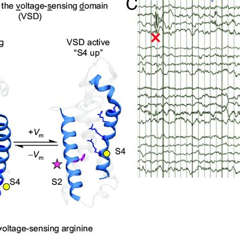 Discovery Of A Kcna2 Mutation In A Patient With Epilepsy A Membrane Download Scientific