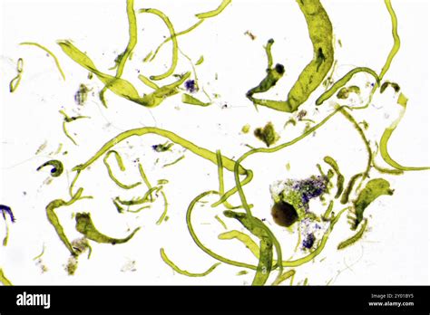 Marine Green Microalgae Under The Microscope In Front Of A White