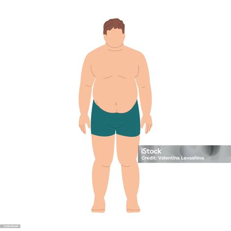 뚱뚱한 남자 환자 초과 중량 비만 당뇨병 과식 호르몬 불균형 및 갑상선 흰색 배경에 격리 된 스톡 벡터 그림입니다 건강관리와
