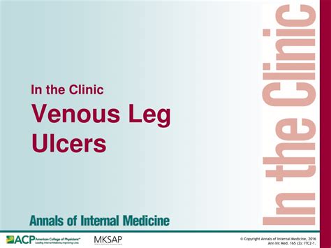 Ppt Venous Leg Ulcers Powerpoint Presentation Free Download Id9414758