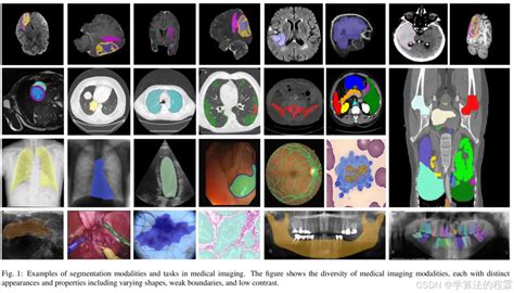 Medical Image Analysis：医学图像分割最新进展综述recent Advances In Medical Imaging