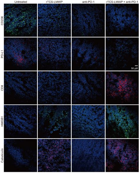 The Immunofluorescence Staining Of Cd206 Pd L1 Cd8 Hmgb1 And Download Scientific Diagram