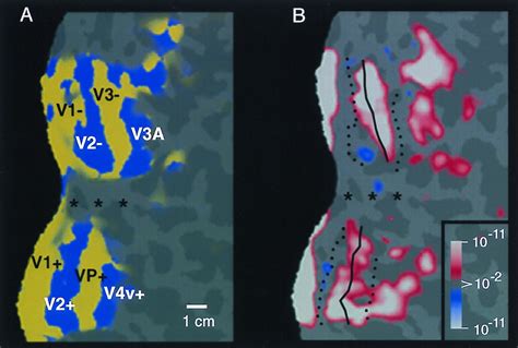 The Representation Of The Ipsilateral Visual Field In Human Cerebral Cortex Pnas