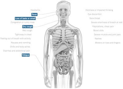 Could My Symptoms Be Covid 19 Tumbex