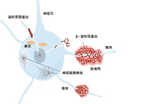 人類的長期抗戰─對抗阿茲海默症 科學月刊science Monthly