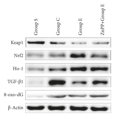 Ursolic Acid Activates The Nrf2 Signaling Pathway After Unilateral Download Scientific Diagram