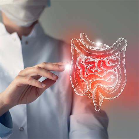 Treatment Of Ulcerative Colitis With Ayurveda Jyoti Ayur Clinic