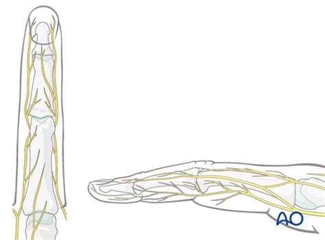 Dorsal Approach To The Metacarpophalangeal Joints