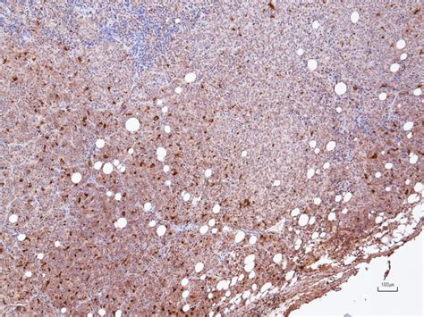 Galectin 3 Ihc Staining Someone That Already Performed It In