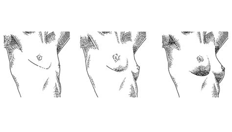 Breast Development Timeline