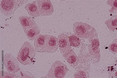 Root Tip Of Onion And Mitosis Cell In The Root Tip Of Onion Under A Microscope Stock Photo