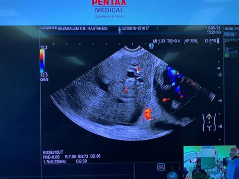 4th Mena Eus Ercp Workshop Mena Eus Club