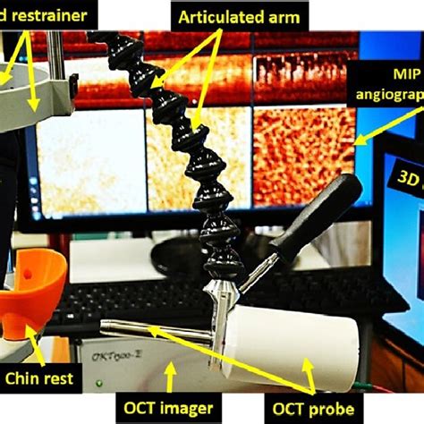 optical coherence tomography angiography octa acquisition system