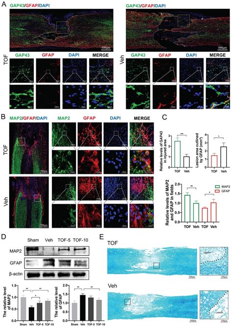 Tof Promotes Neural Structure Regeneration And Inhibits Glial Scar